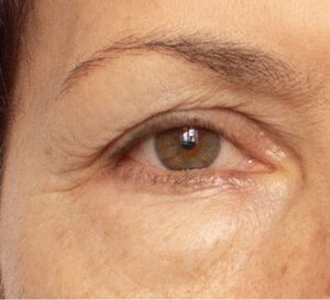 Cosmetic Surgery Liverpool | Treatments for Cosmetic Surgery