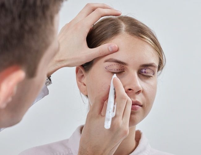 Blepharoplasty Liverpool | Transform Your Eyes